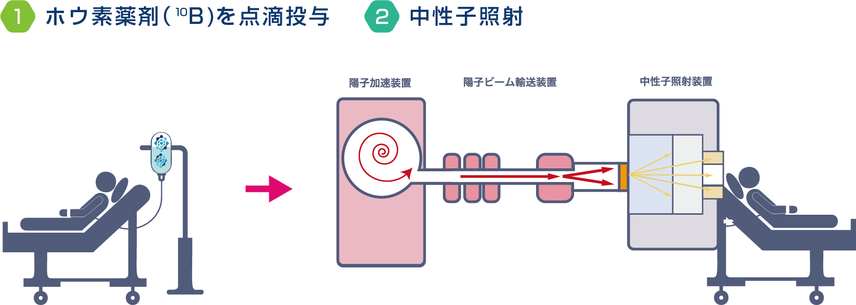 ホウ素中性子捕捉療法（BNCT） | 頭頸部がんの治療方法 | 頭頸部がん治療を知る | 頭頸部がんとともに | ステラファーマ株式会社